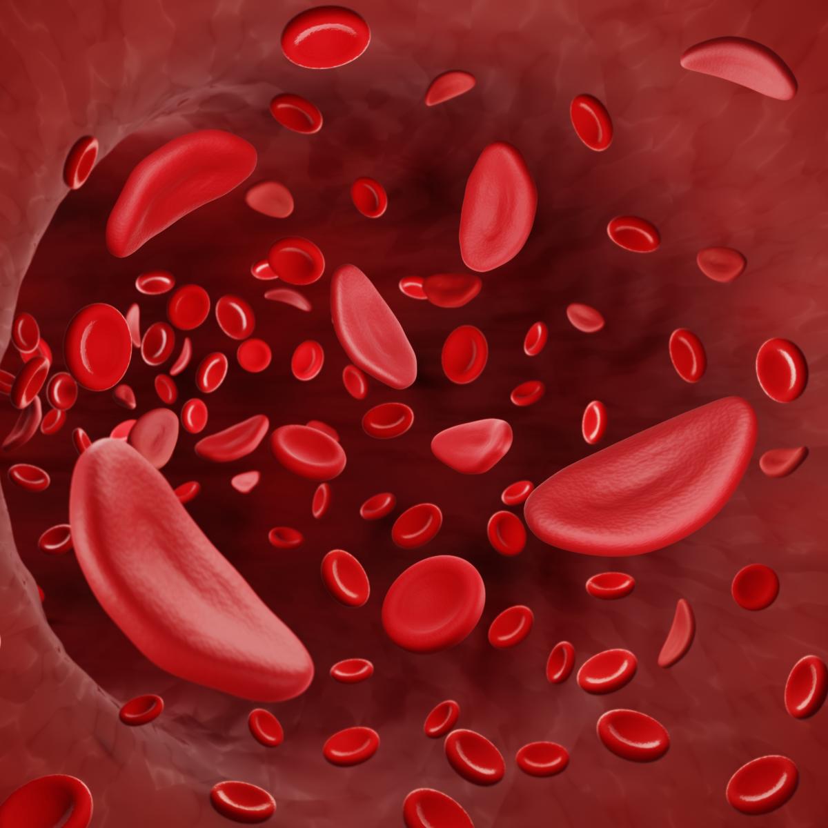 National Sickle Cell Anaemia Elimination Mission – CrackitToday Affairs National Sickle Cell Anaemia Elimination Mission – CrackitToday Affairs